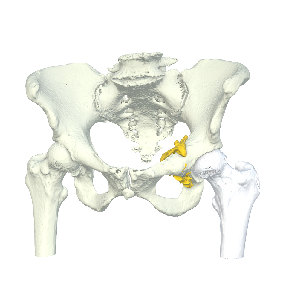 ROYP106901P V1 | Interactive 3D view